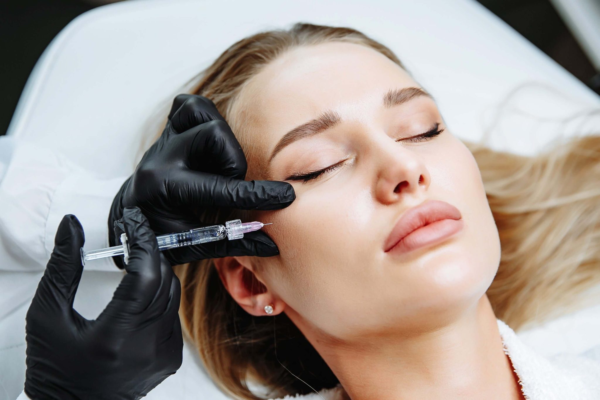 Radiesse (Fillers) & injectables - Illumin8Skin